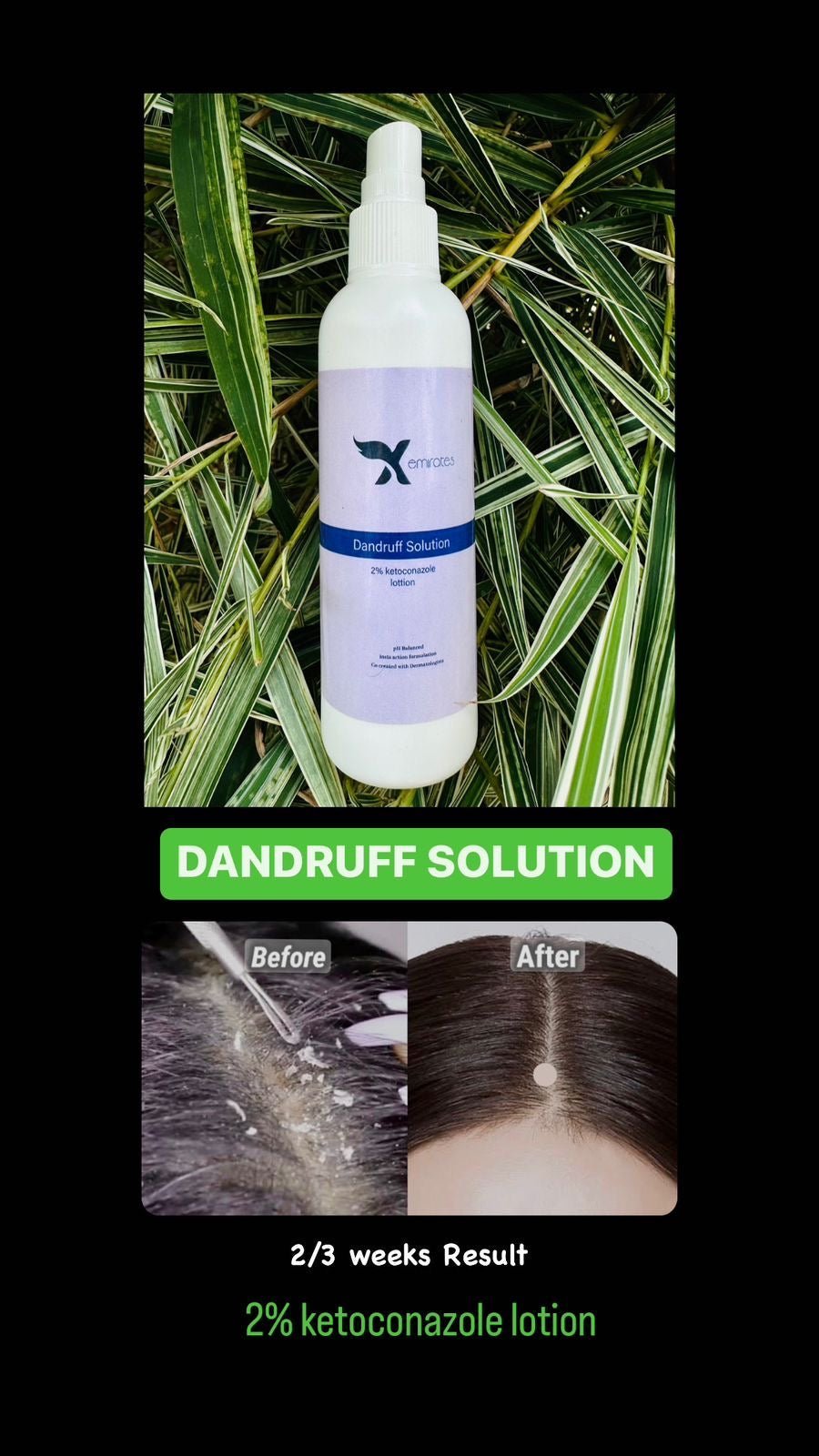 Dandruff Solution - Cream X Emirates